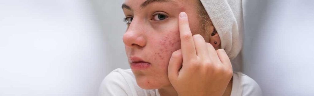 the ABCs of clear skin: your back-to-school guide – Pure Haven